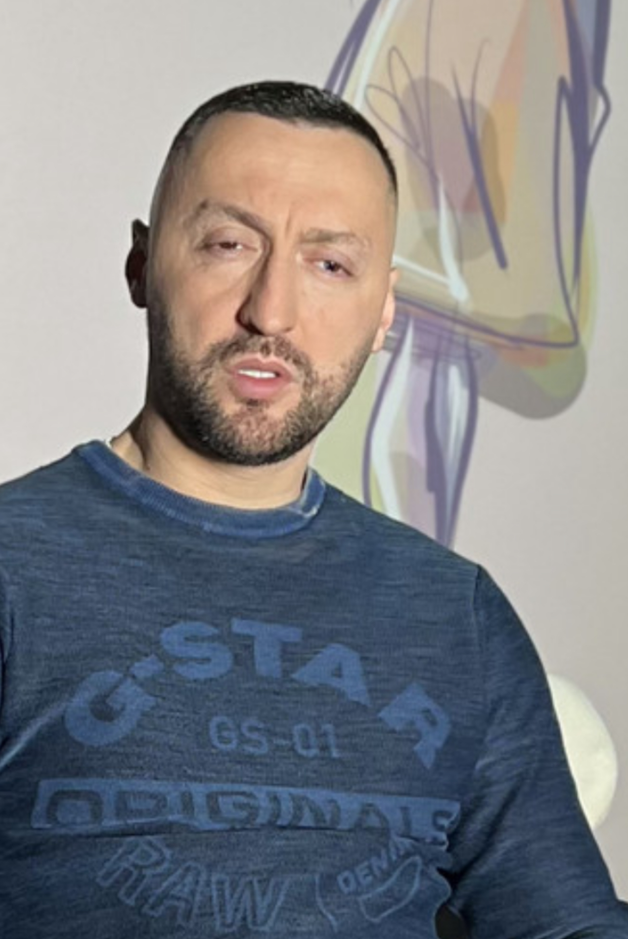 G-Bani tregon rezultatin përfundimtar: Ja si duket syri i tij pas ...